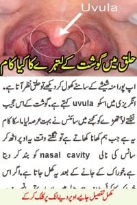 Swollen Uvula: Causes and Treatment for Uvulitis – Daily