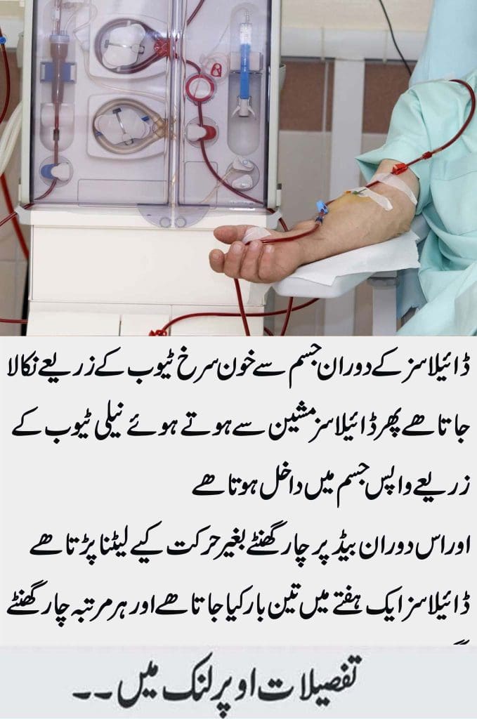 Hemodialysis Definition, Procedure, And Types – Daily